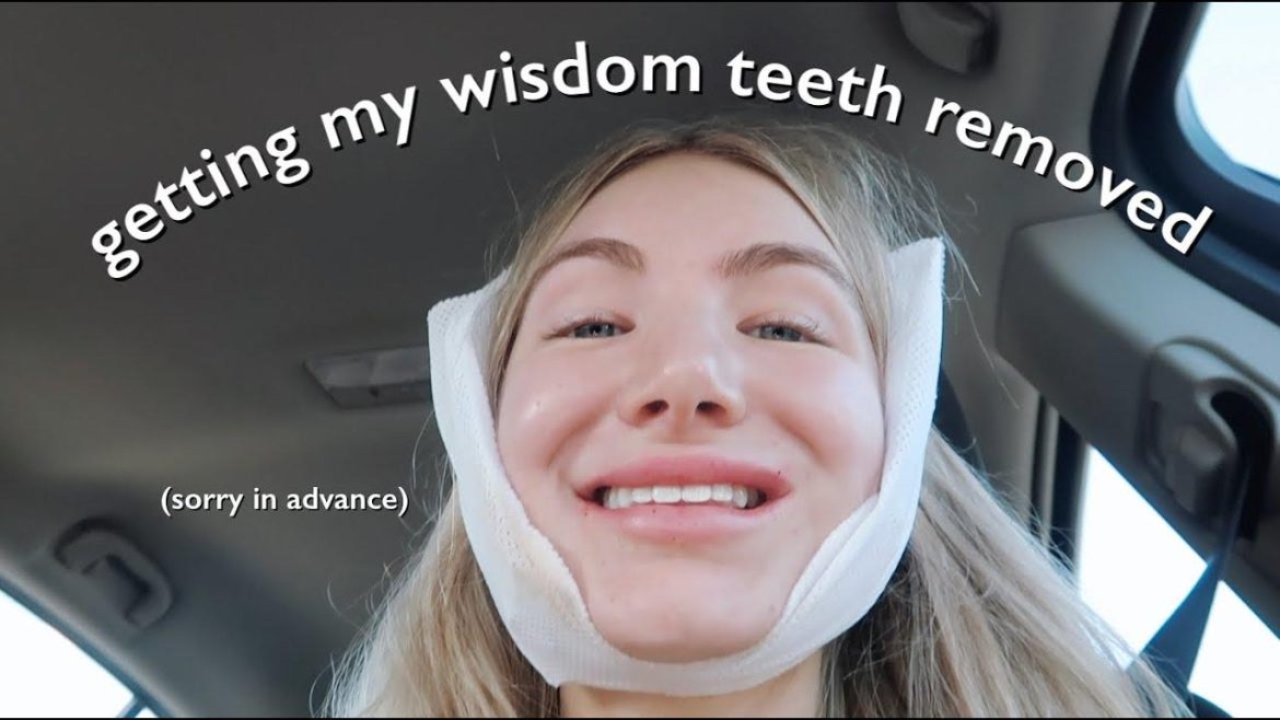 What To Expect After Having 4 Wisdom Teeth Removed - Dailytoothcare.com