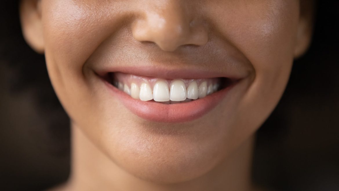 What Percentage Of Hydrogen Peroxide Is Best For Teeth Whitening ...