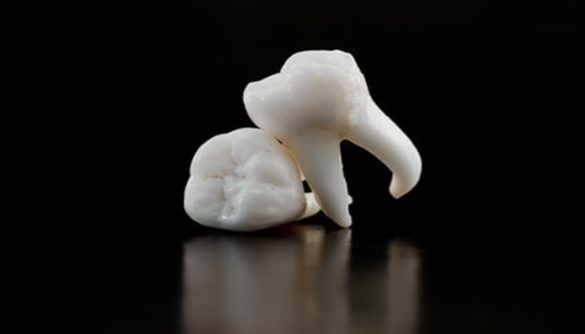 What Do Wisdom Teeth Look Like? - Dailytoothcare.com